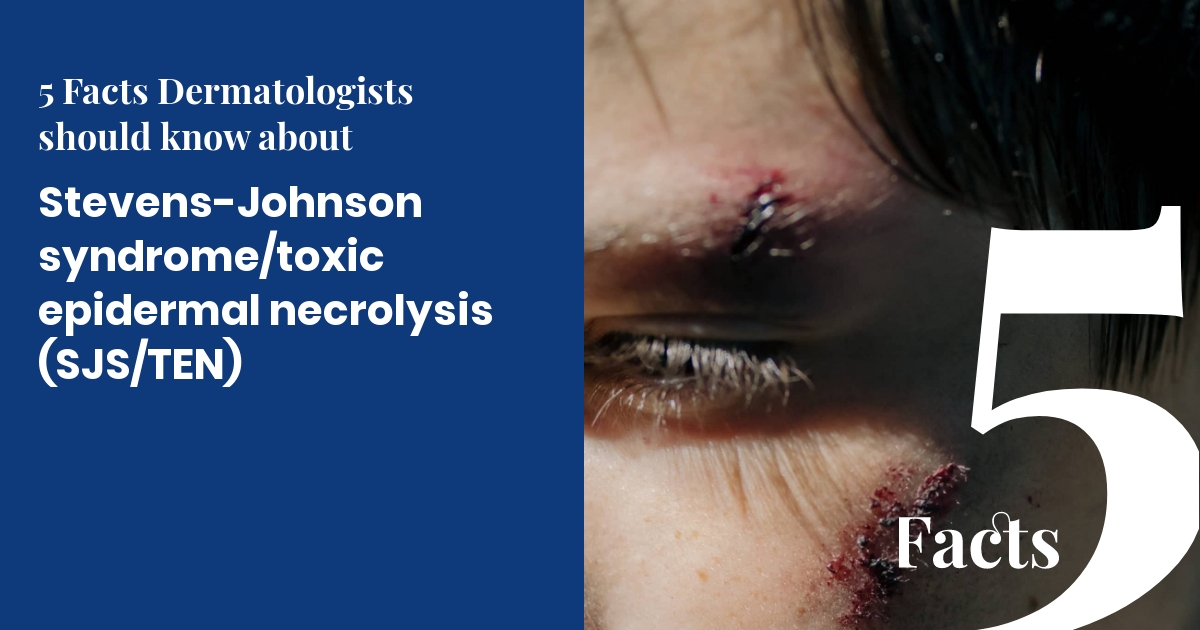 Stevens-Johnson syndrome/toxic epidermal necrolysis (SJS/TEN) – Rare Dermatology News